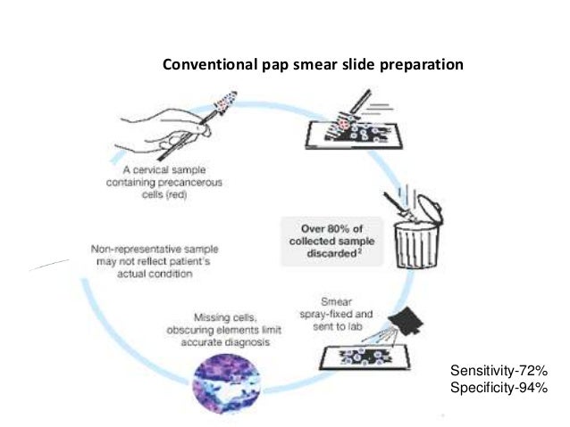 Liquid based cytology