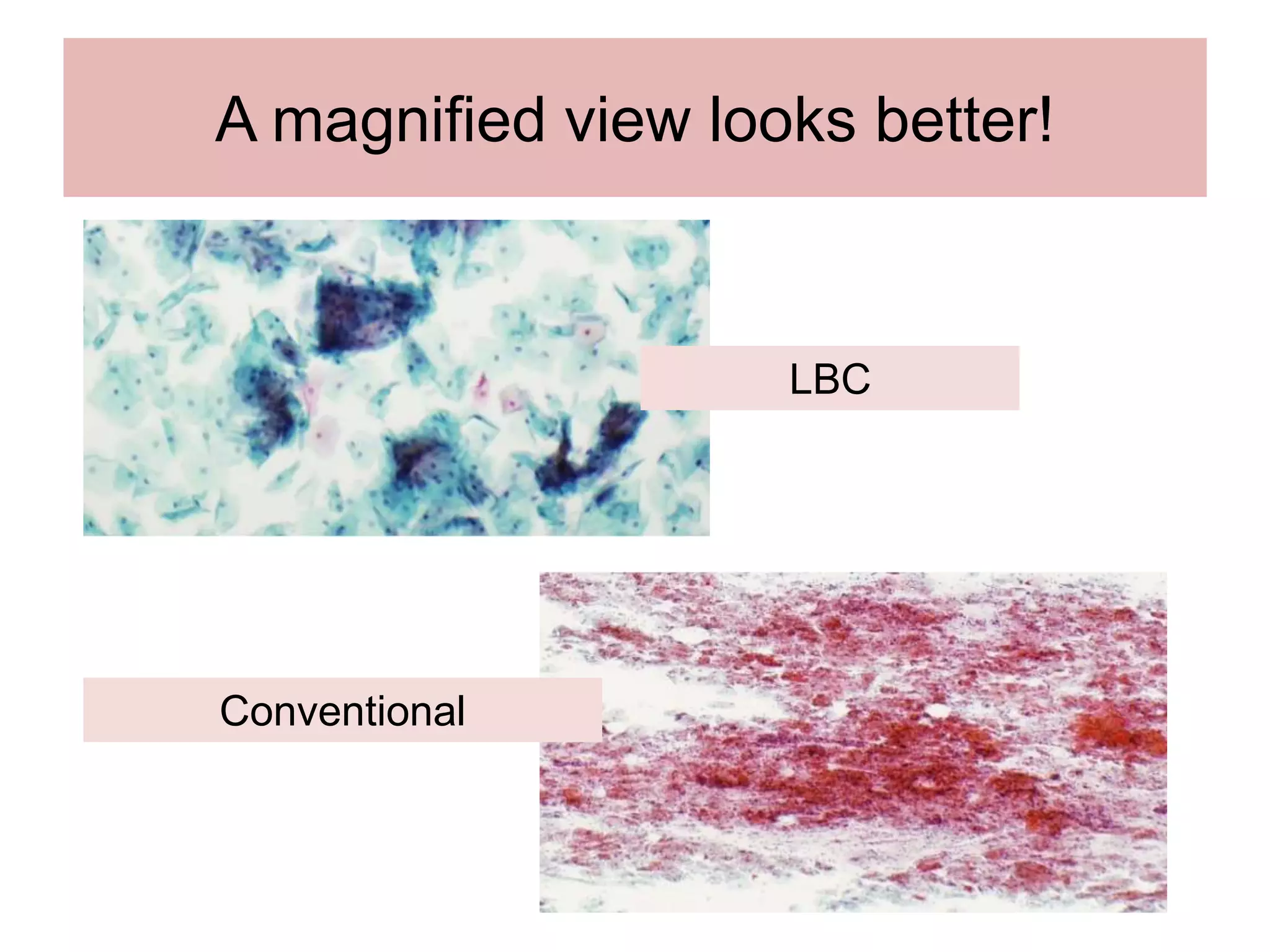Why change to liquid based cytology | PPTX