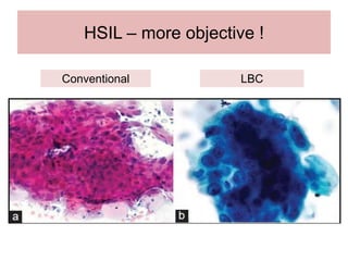 Why change to liquid based cytology | PPTX