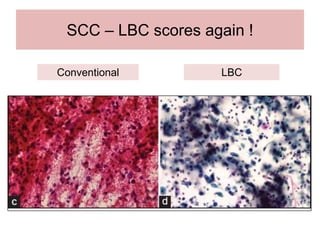 Why change to liquid based cytology | PPT