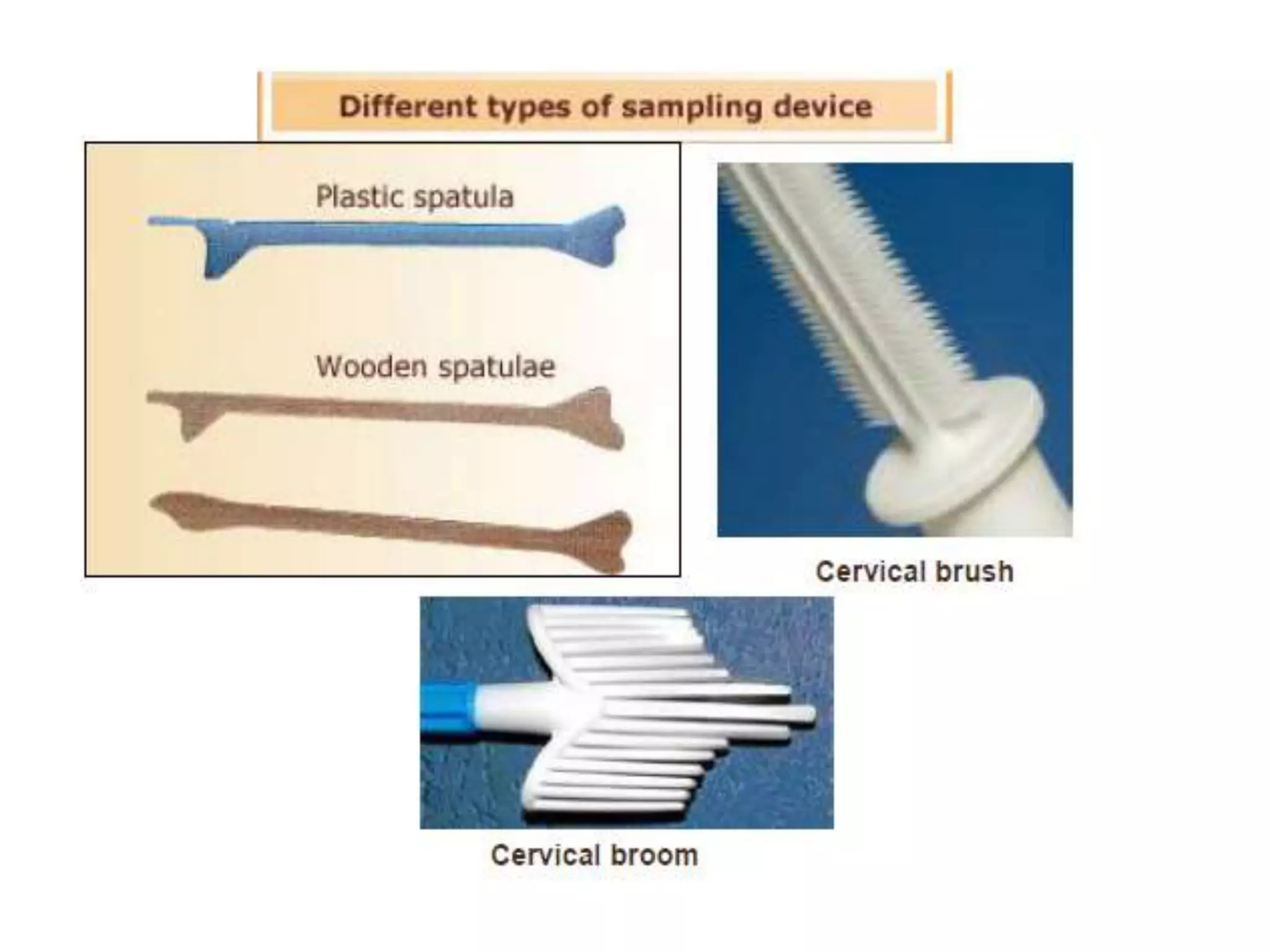 Liquid Based Cytology.pptx