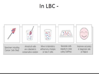 Liquid Based Cytology.pptx