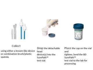 Liquid Based Cytology.pptx