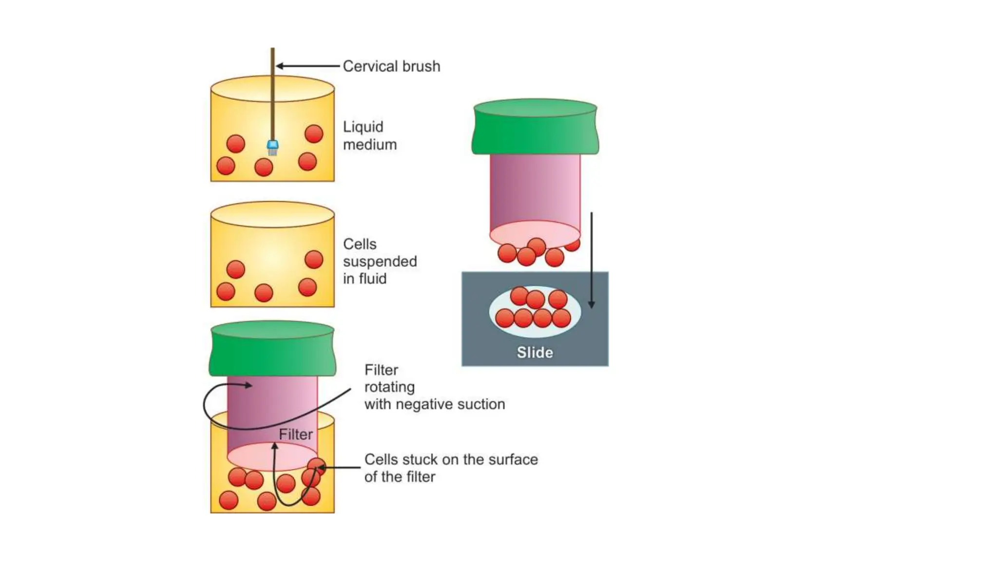 Liquid based cytology pathology CYTOLOGY.pptx