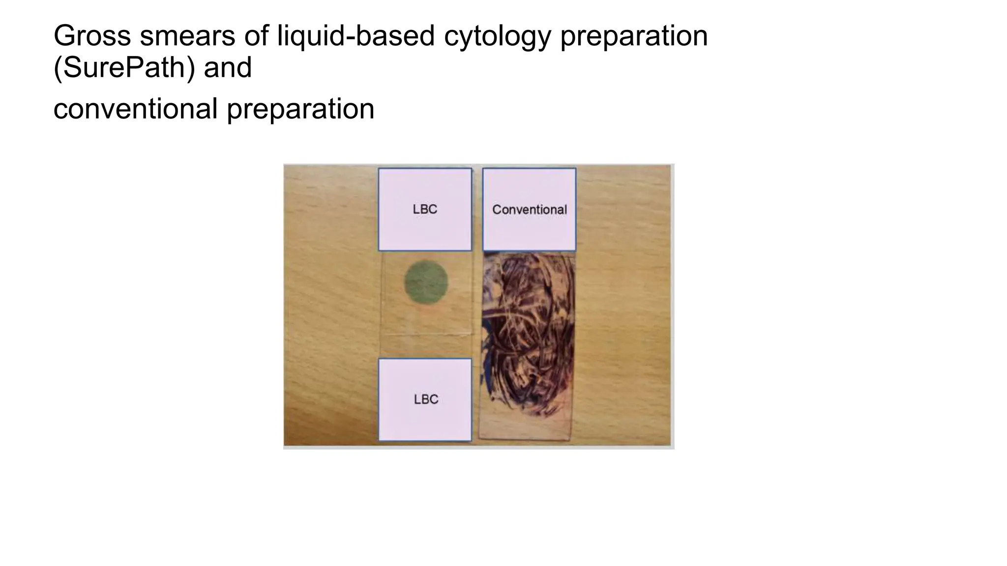 Liquid based cytology pathology CYTOLOGY.pptx