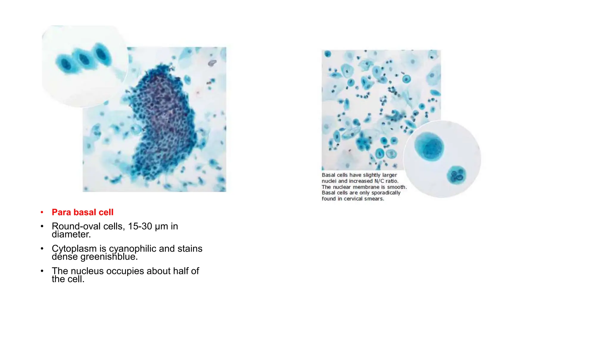 Liquid based cytology pathology CYTOLOGY.pptx