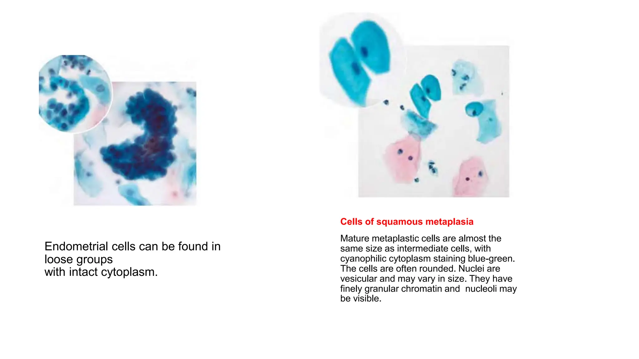 Liquid based cytology pathology CYTOLOGY.pptx