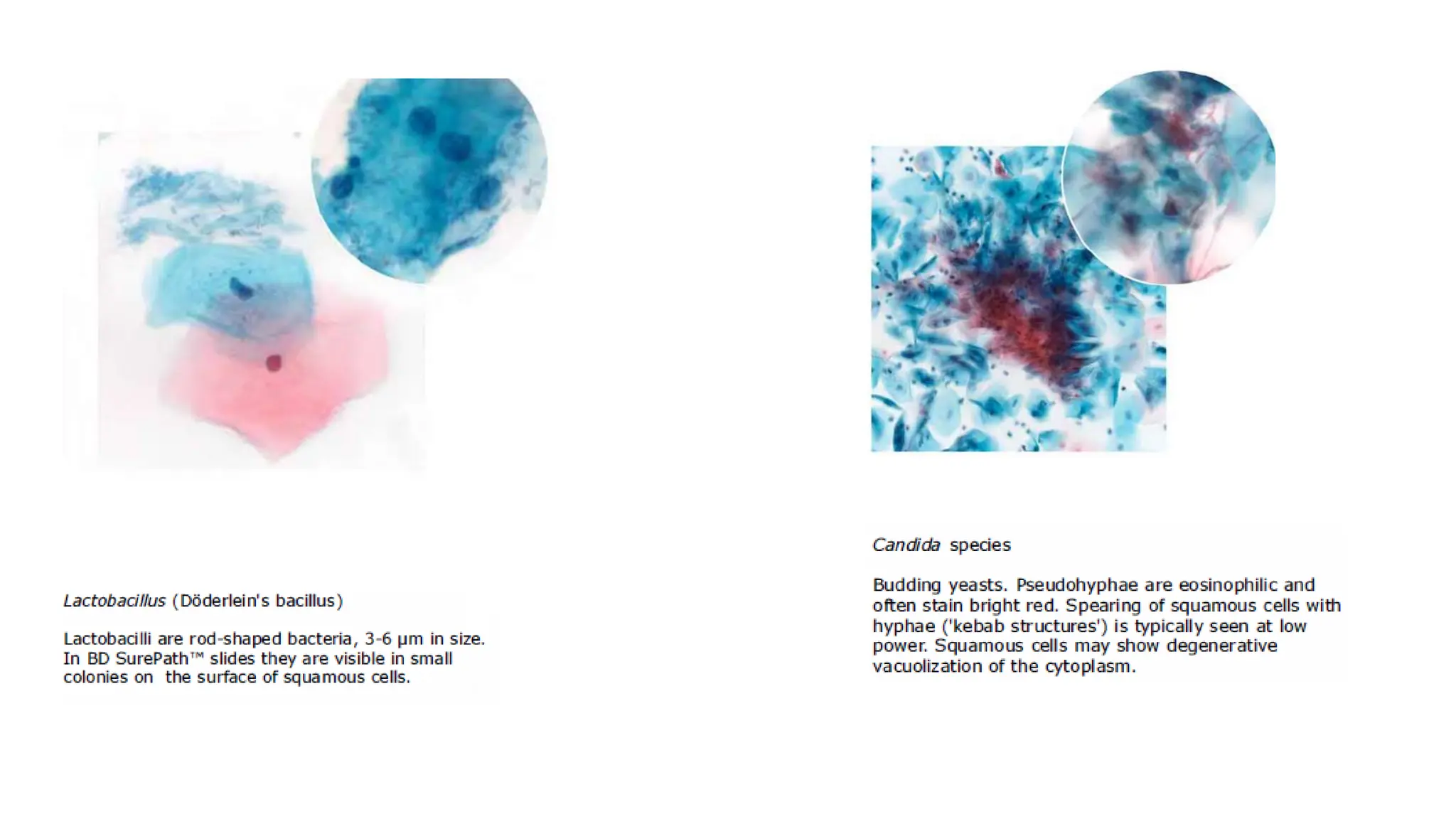 Liquid based cytology pathology CYTOLOGY.pptx