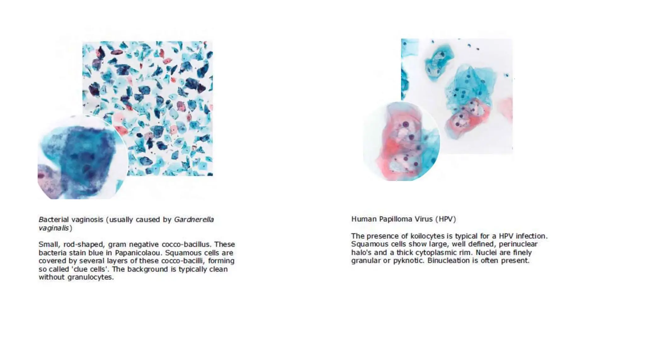 Liquid based cytology pathology CYTOLOGY.pptx