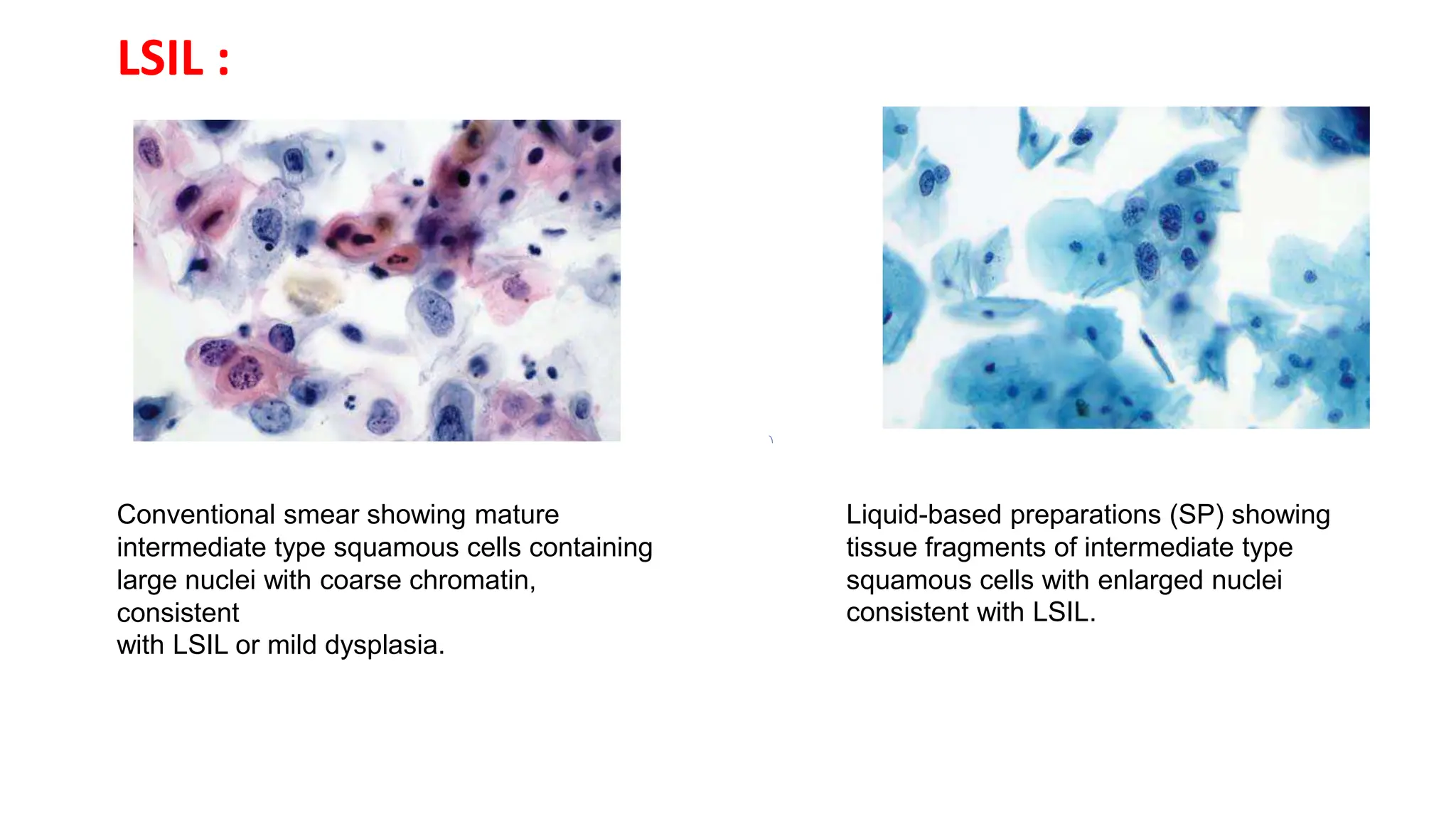 Liquid based cytology pathology CYTOLOGY.pptx