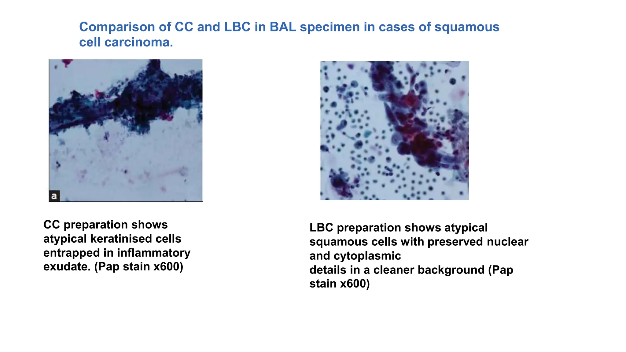 Liquid based cytology pathology CYTOLOGY.pptx