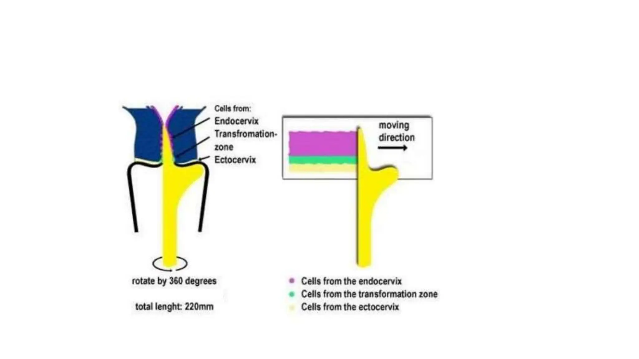 Liquid based cytology pathology CYTOLOGY.pptx