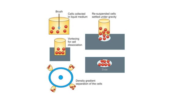 Liquid based cytology pathology CYTOLOGY.pptx
