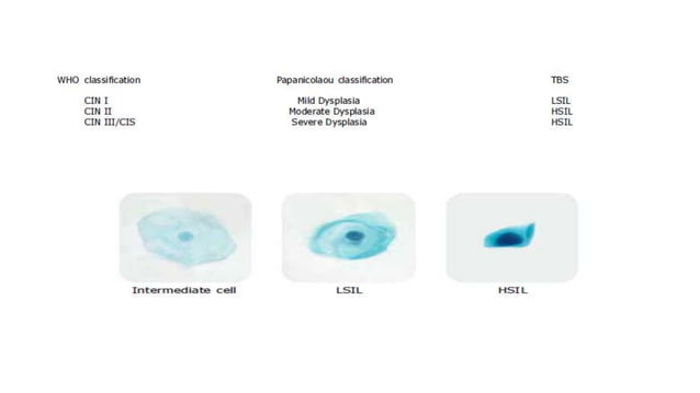 Liquid based cytology pathology CYTOLOGY.pptx