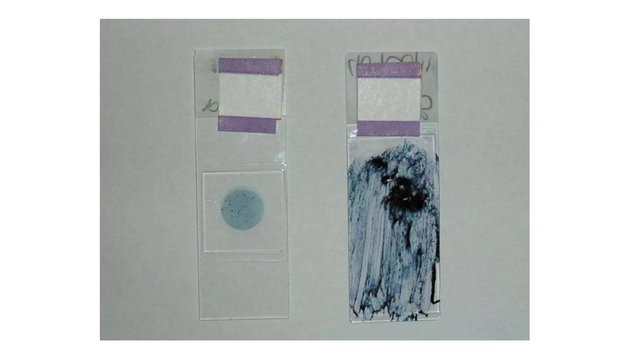 Liquid based cytology | Abdul Quddus | PPTX