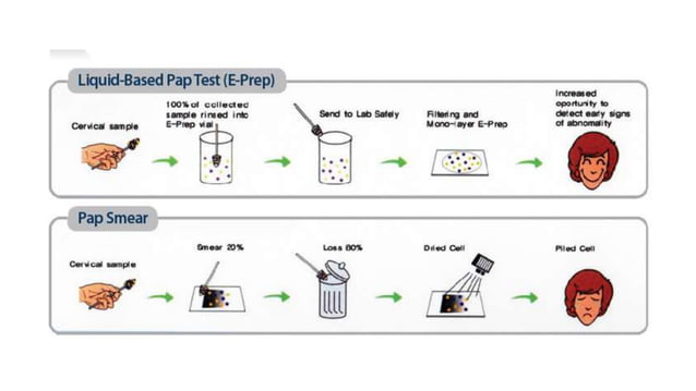 Liquid based cytology | Abdul Quddus | PPTX