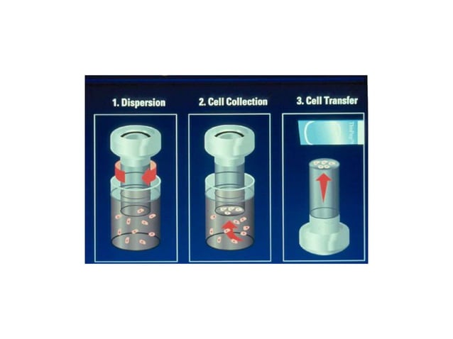 Liquid based cytology ( l b c) | PPTX