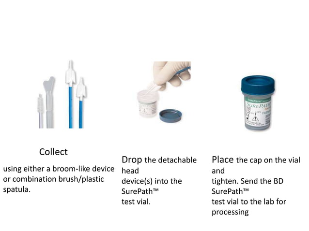 Liquid based cytology ( l b c) | PPTX
