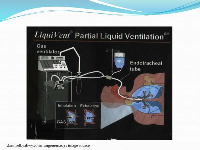 Liquid breathing | PPTX | Lung and Respiratory Health | Diseases and ...