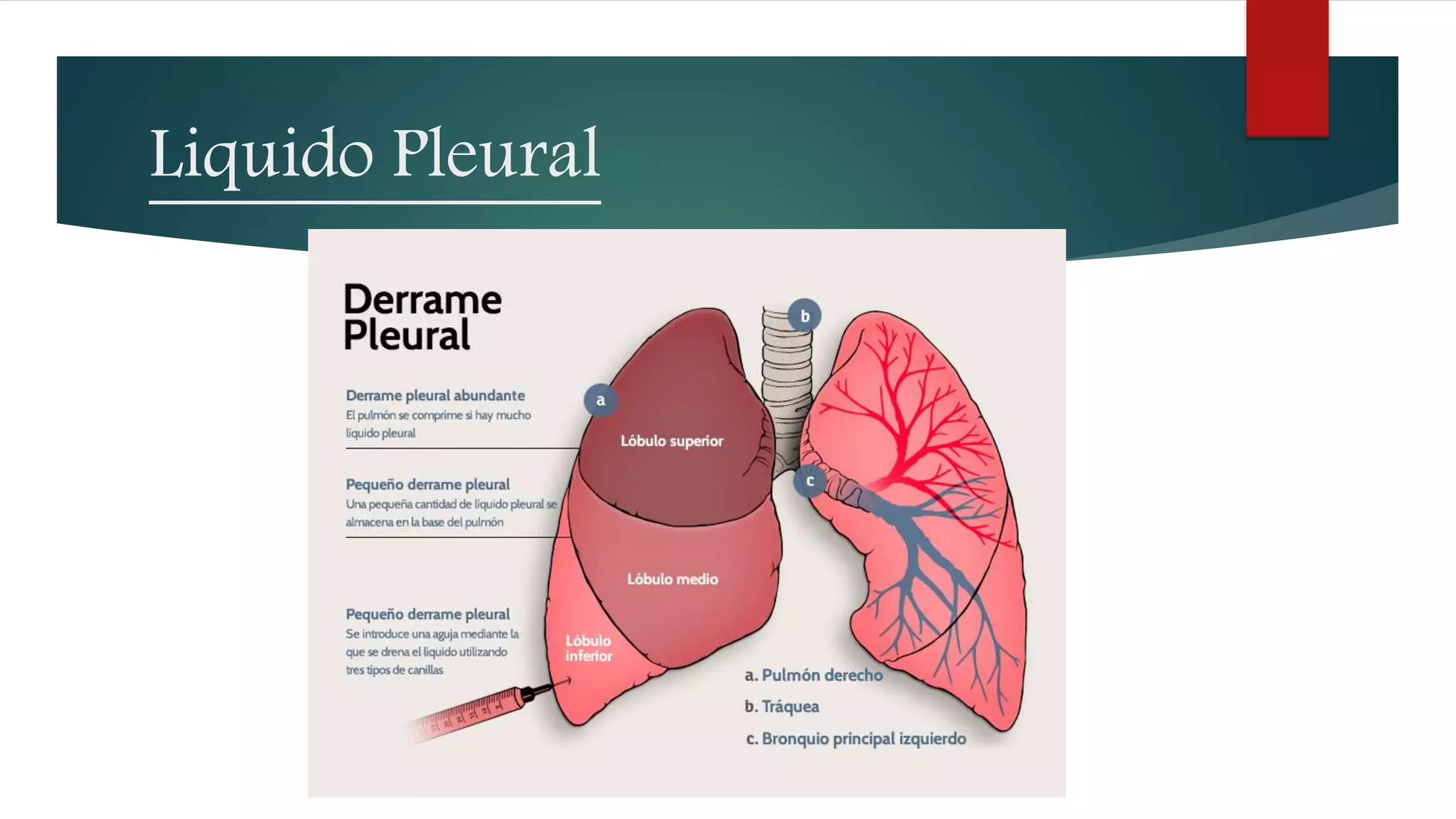Liquido pleural | PPTX