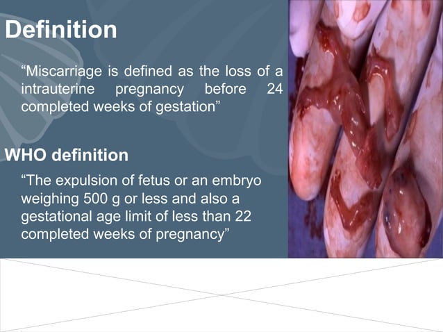 Miscarriages,,!!! | PPT | Pregnancy | Reproductive Health