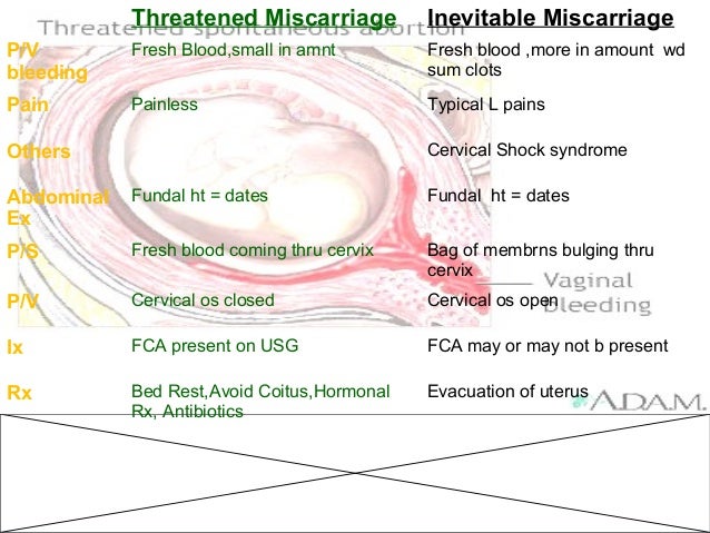 Fetal Tissue Miscarriage
