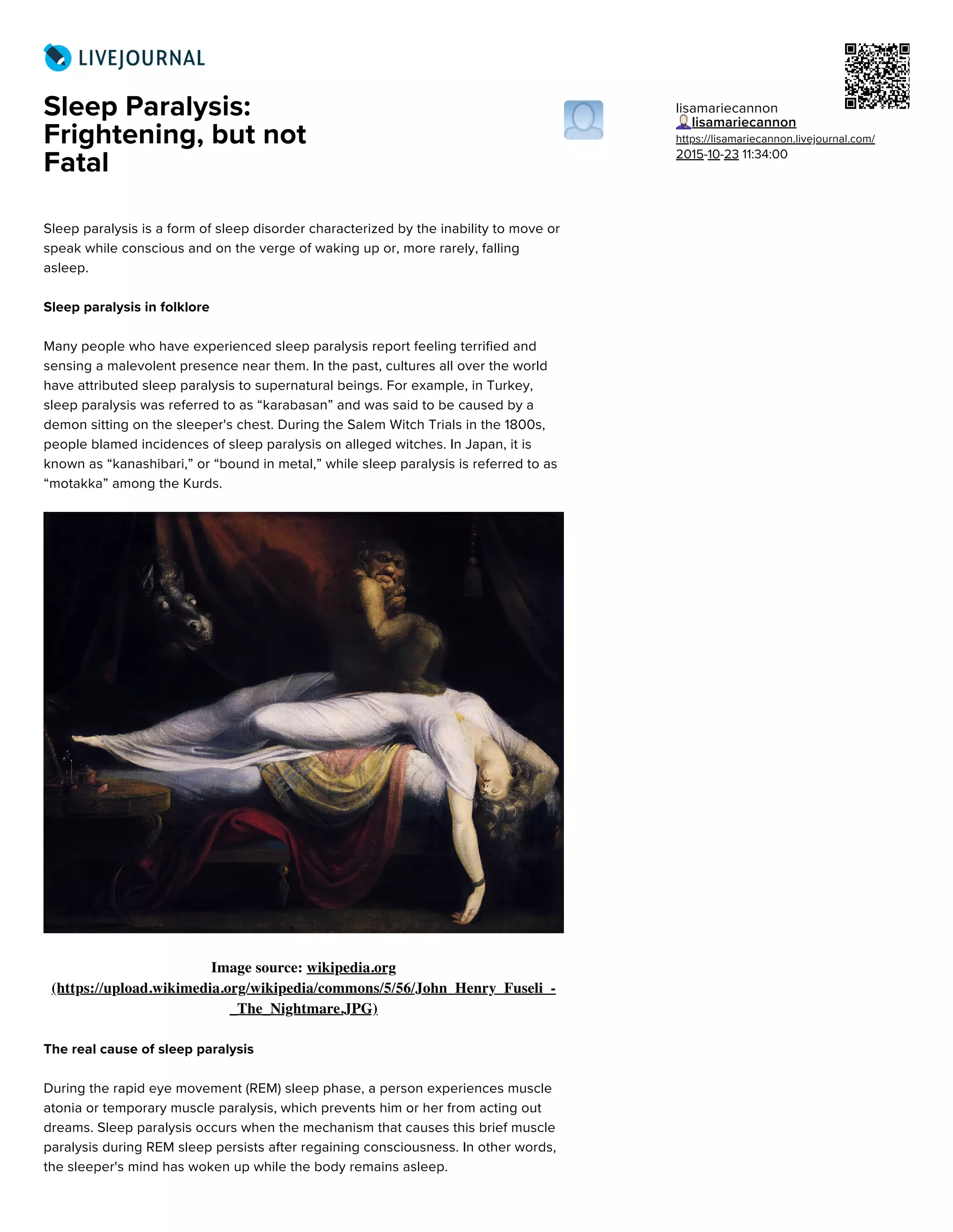 Sleep Paralysis: Frightening, but not Fatal | PDF