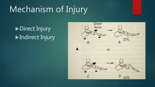Lisfranc injury | PPTX