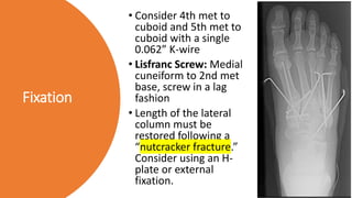 AJM Sheet: Lisfranc Trauma | PPTX