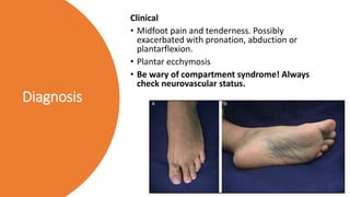 AJM Sheet: Lisfranc Trauma | PPTX
