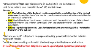 AJM Sheet: Lisfranc Trauma | PPTX