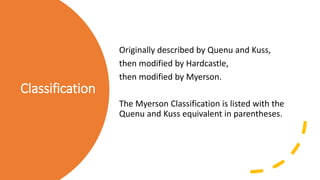 AJM Sheet: Lisfranc Trauma | PPTX
