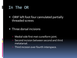 Lisfranc injury in orhopaedics and traumatologypptx | PPTX