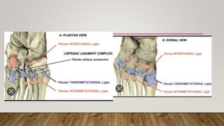 Lisfranc fracture of lower extrimities.pptx