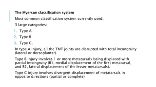 Lisfranc injuries | PPTX