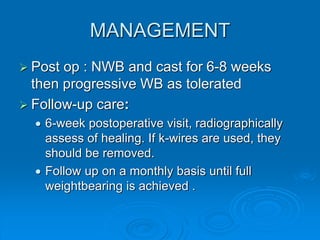 LISFRANC INJURIES.ppt