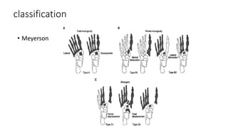 approach to LISFRANC INJURIES of the foot | PPT