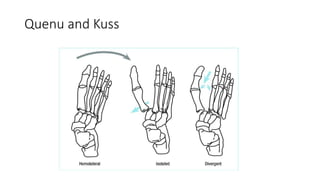 approach to LISFRANC INJURIES of the foot | PPT