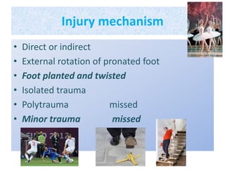 Lisfranc injuries -surgical management , dr mohamed ashraf ,HOD ...
