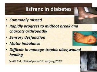 Lisfranc injuries -surgical management , dr mohamed ashraf ,HOD ...