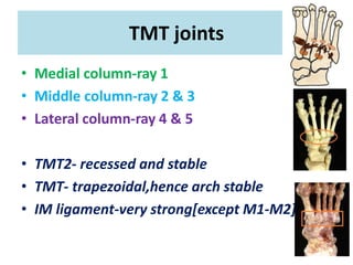 Lisfranc injuries -surgical management , dr mohamed ashraf ,HOD ...