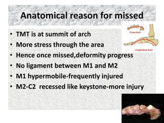 Lisfranc injuries -surgical management , dr mohamed ashraf ,HOD ...