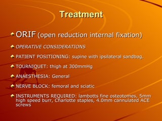 Lis Franc Injury | PPT