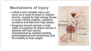 Lisfranc injury | PPTX