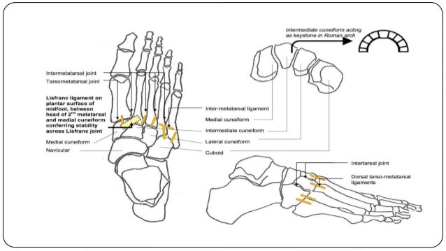 Lisfranc Joint Orif Fracture Joints Anatomy Figure Procedure Sketch ...