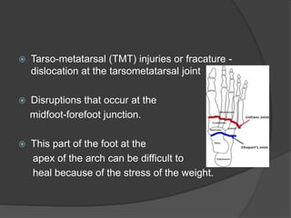 Lisfranc injury | PPTX
