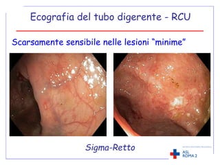 L’ecografia nell’ambulatorio del Gastroenterologo | PPTX