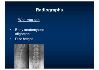Appropriate imaging for back pain | PPT