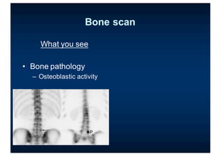 Appropriate imaging for back pain | PPT