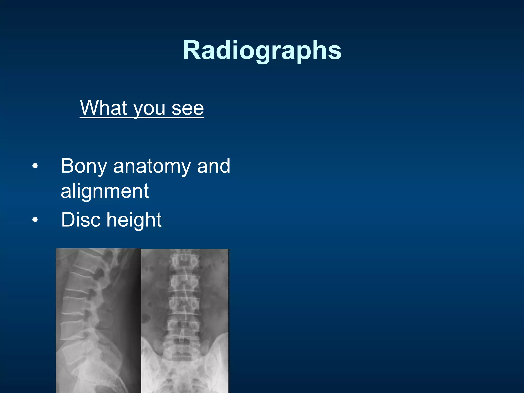 Appropriate imaging for low back pain | PDF